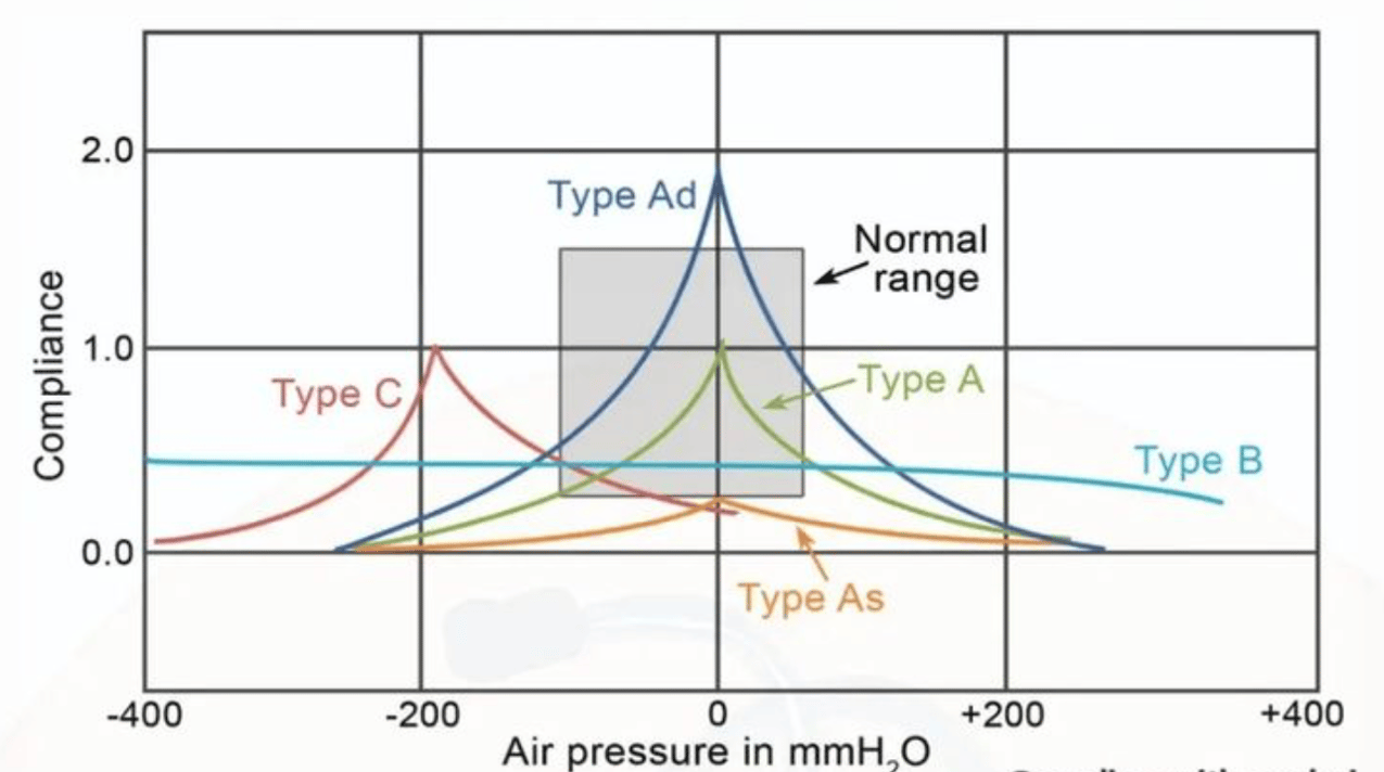 Guide complet pour comprendre les audiogrammes | Perte Auditive